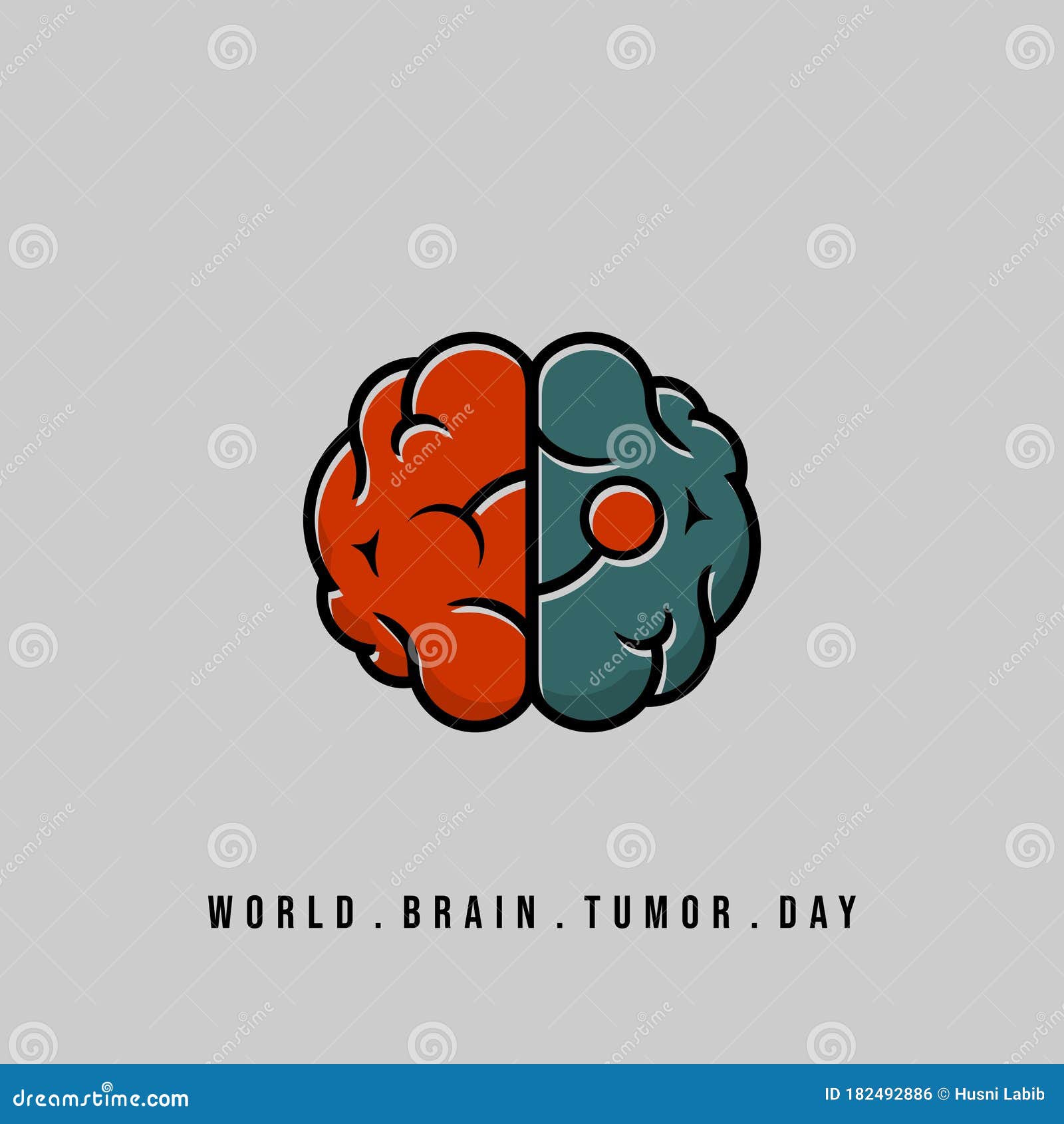 Vector Illustration of Brain with Brain Tumor in Part Stock Vector ...