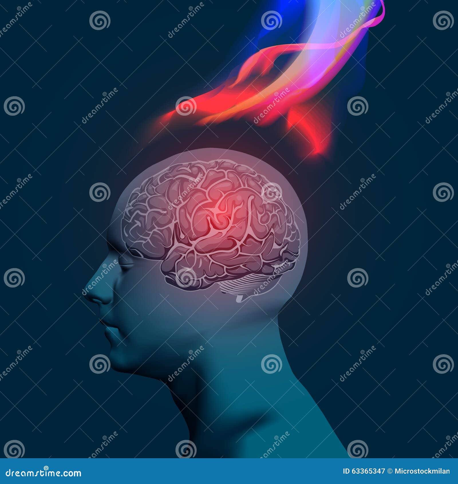 Vector Illustration of Headache with Flames Stock Vector - Illustration ...