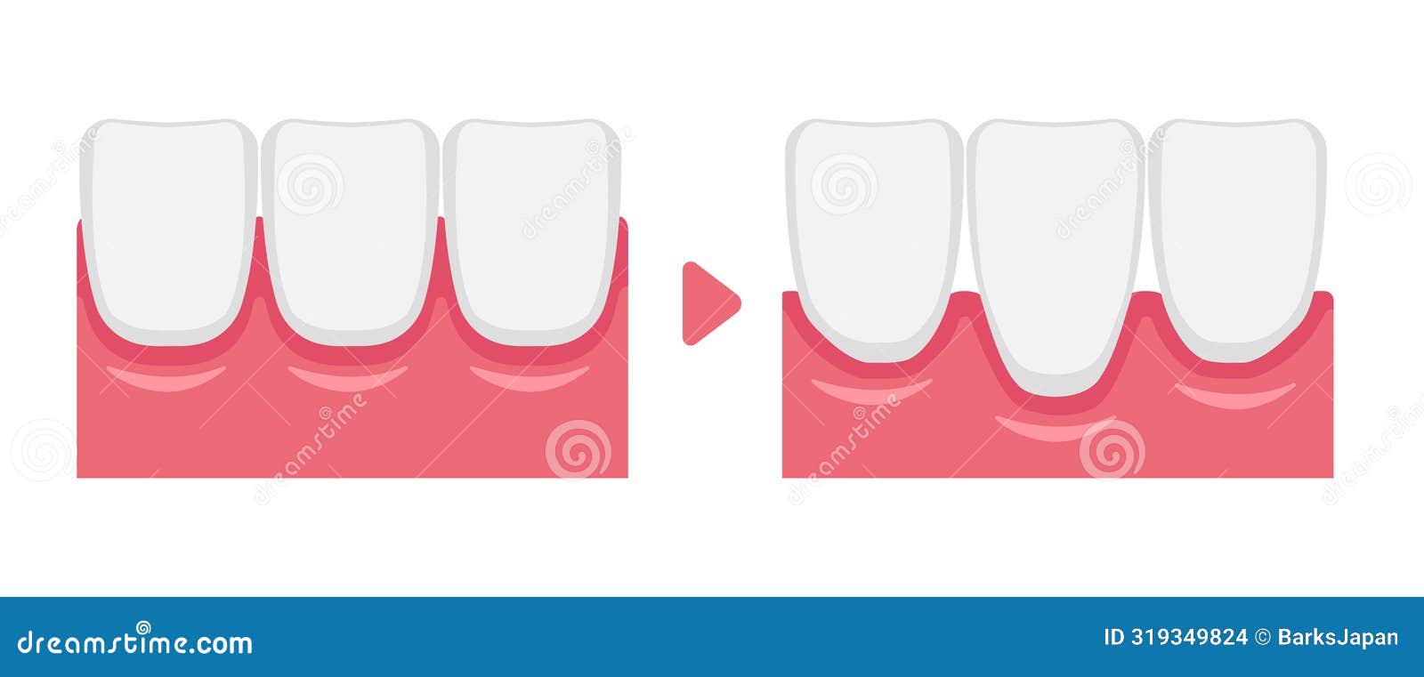 Gingival Cartoons, Illustrations & Vector Stock Images - 345 Pictures ...