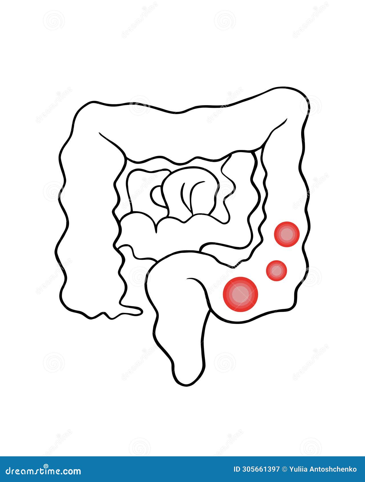 Vector Illustration of Human Intestine.Constipation. Intestinal ...