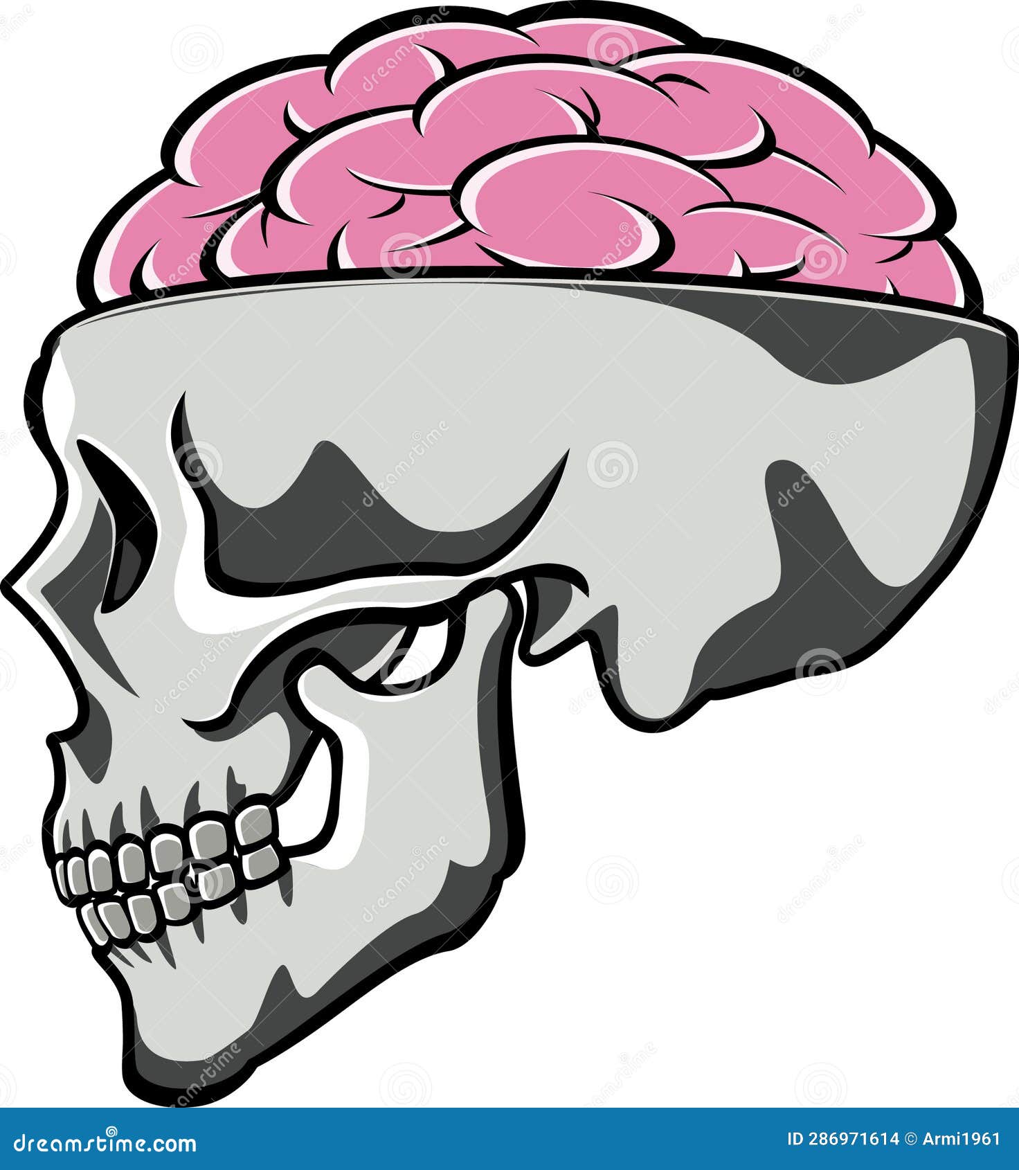 Vector Illustration of Human Skull with Brain Exposed Stock Vector ...