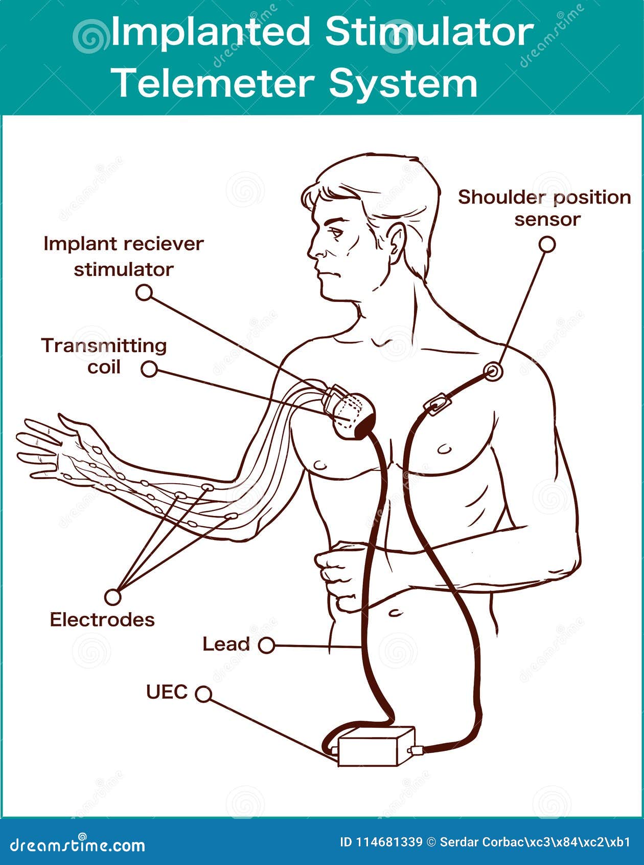 Telemeter Cartoons, Illustrations & Vector Stock Images - 8 Pictures to ...