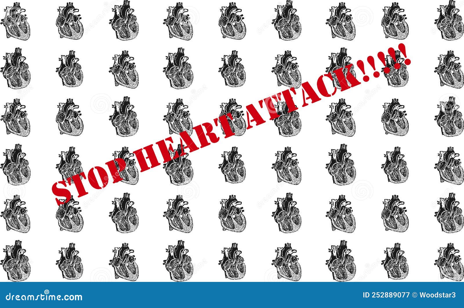 Vector Illustration on an Isolated Background. Stop a Heart Attack ...