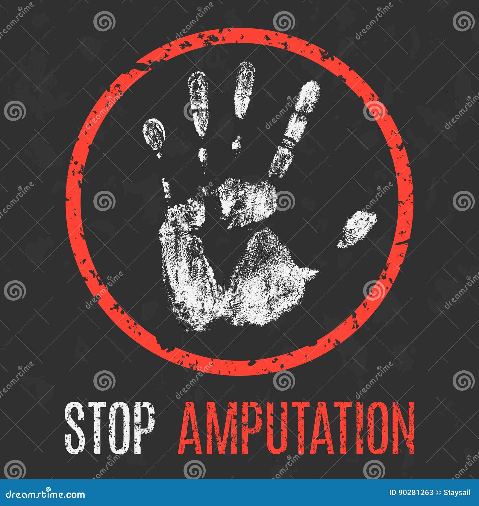 Vector Illustration. the Medical Diagnosis. Stop Amputation Stock ...