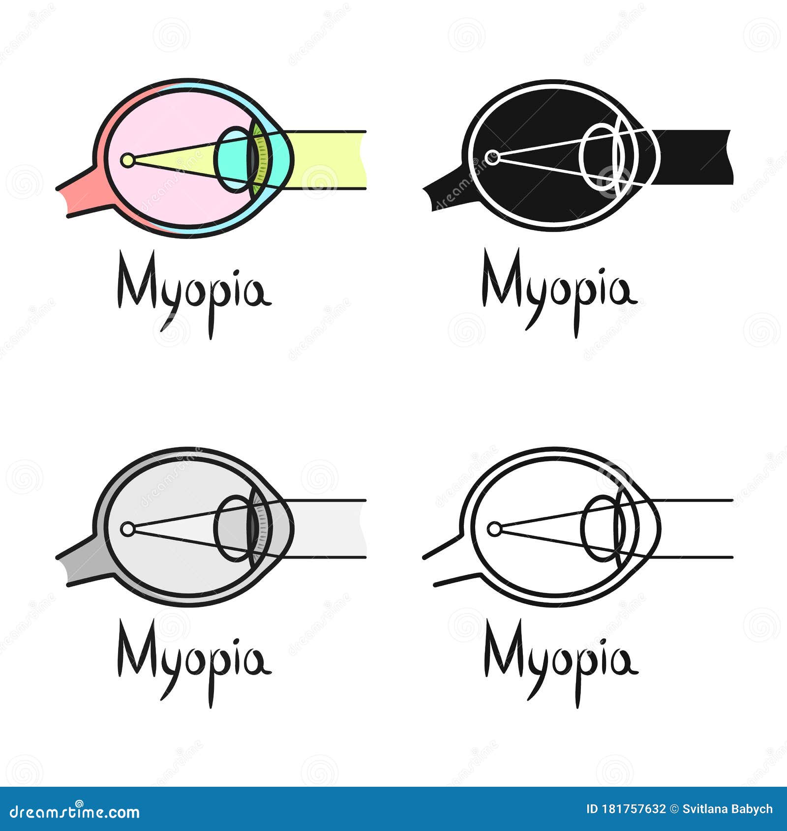 Vector Illustration of Myopia and Eye Symbol. Web Element of Myopia and ...
