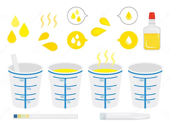 Urine samples for analysis stock vector. Illustration of container ...