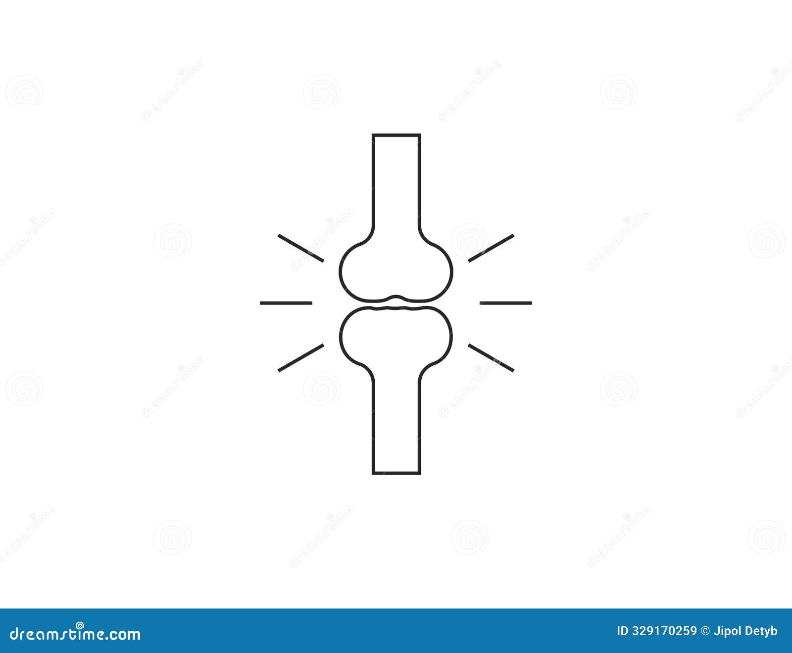 Osteoporosis Bone Density Loss Disease Medical Infographics Cartoon ...