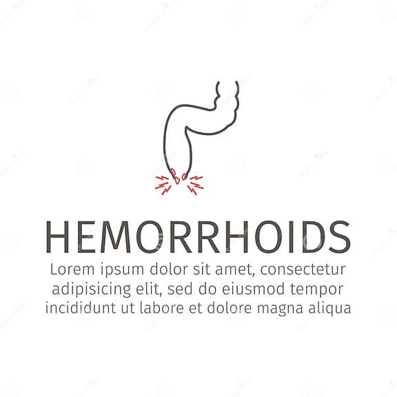 Vector Illustration Of A Prolapsed Hemorrhoid Veins Stock Vector