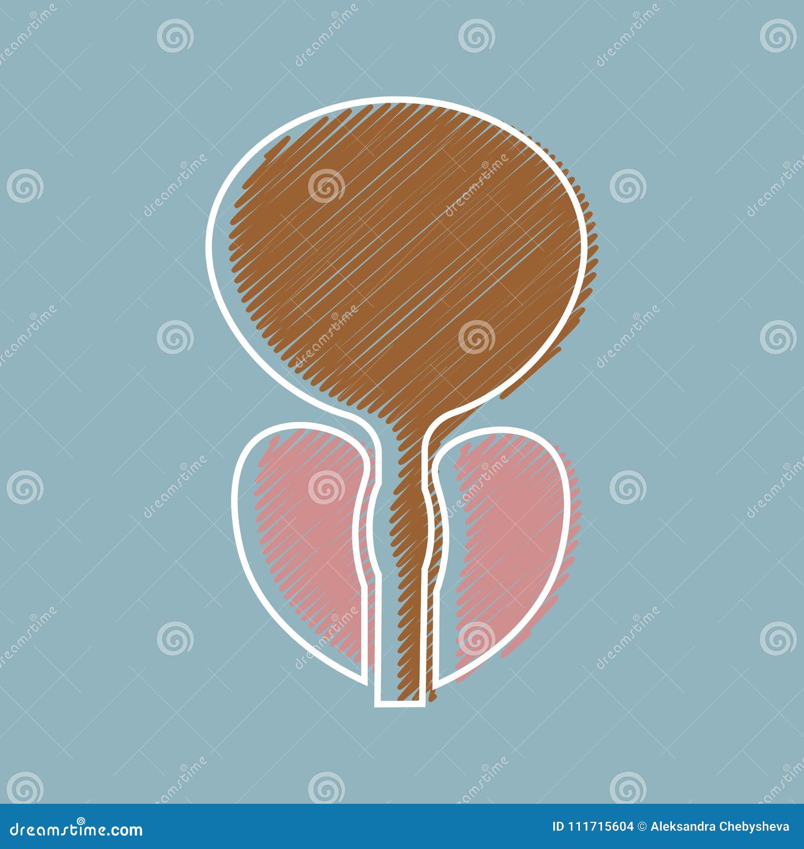 Illustration Of Prostatitis Diagram Normal Vs Enlarged Prostate Cartoon ...
