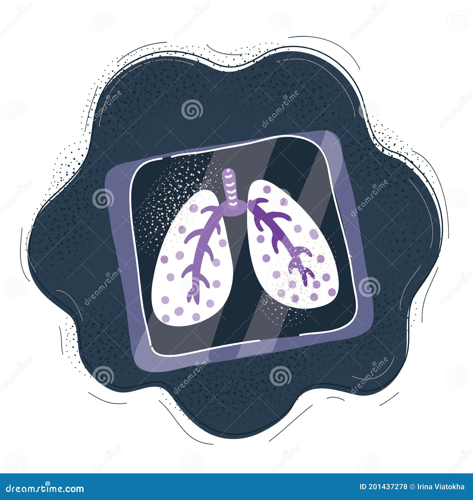 Vector Illustration of X-Ray Image of Human Healthy Chest on Dark ...
