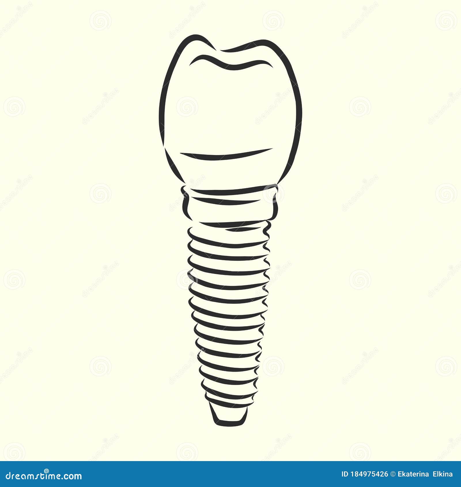 Vector Illustration. Sketches, Dental Implants. Dental Implant, Vector ...