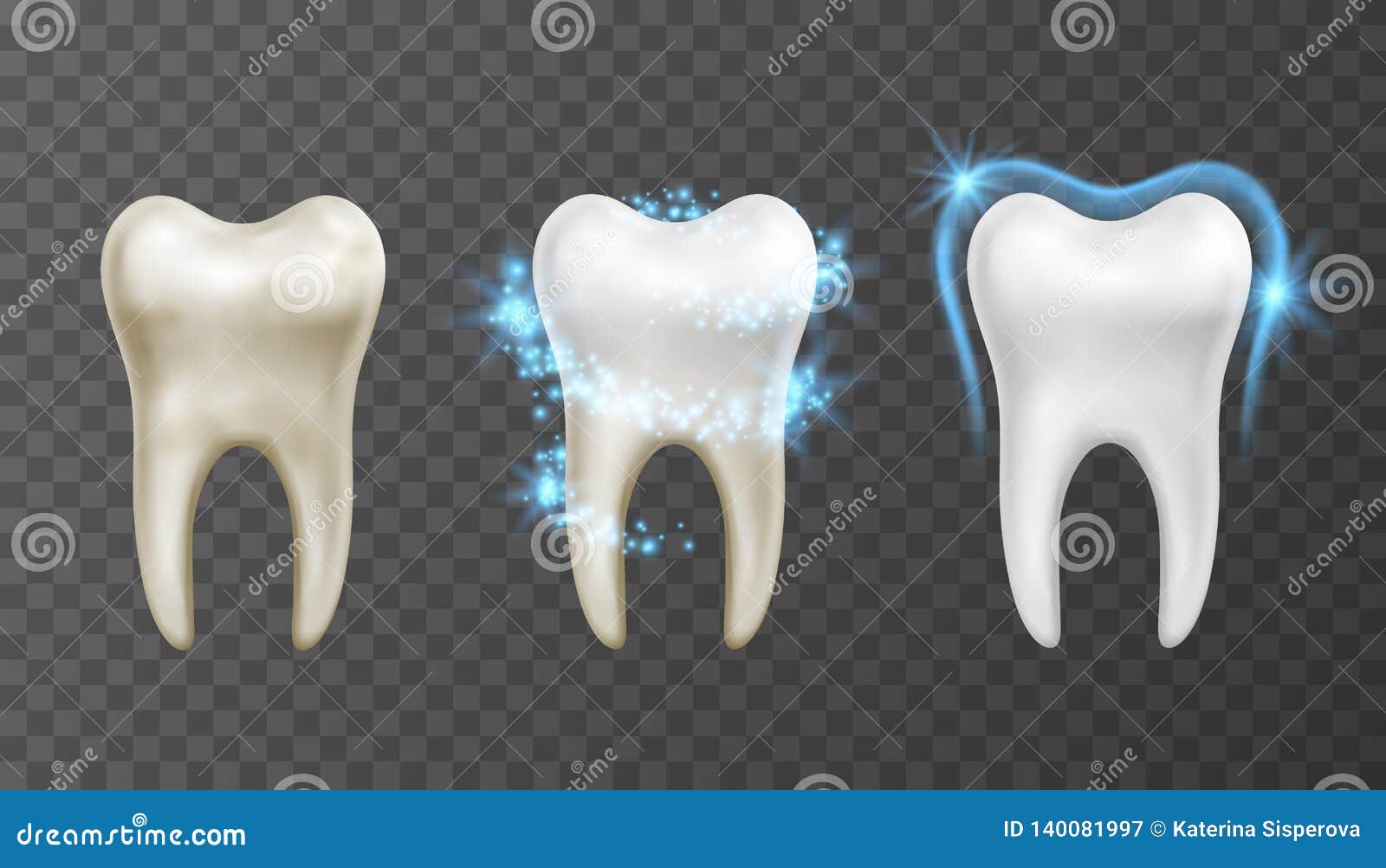 Vector Illustration of Teeth Whitening Process - Cleaning and ...