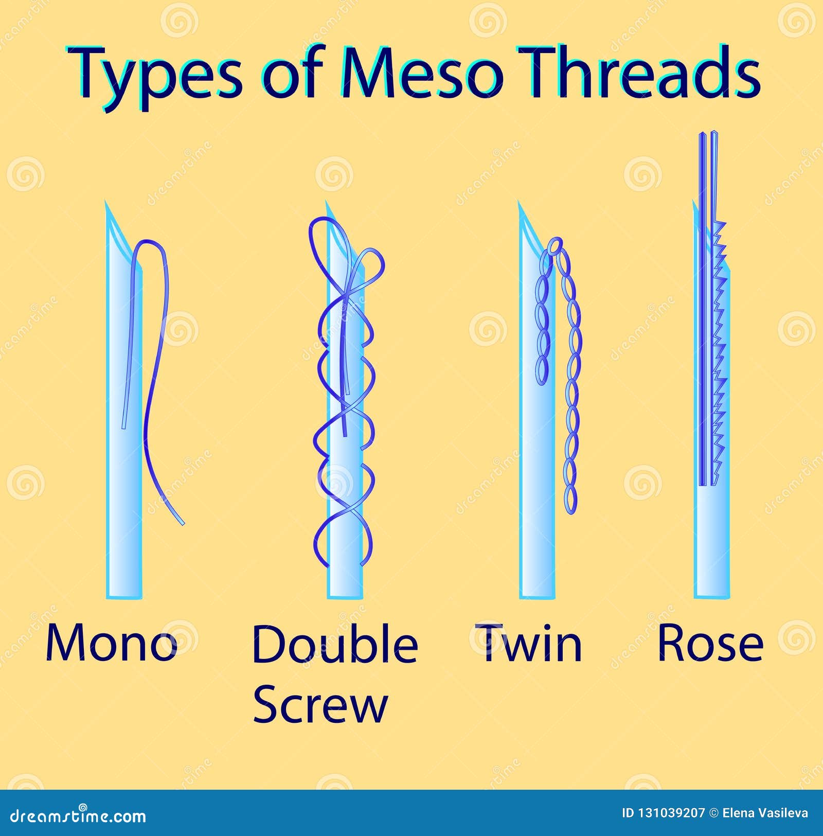 Mesotherapy Threads Lifting. Threads For Facelift. The Structure Of The ...