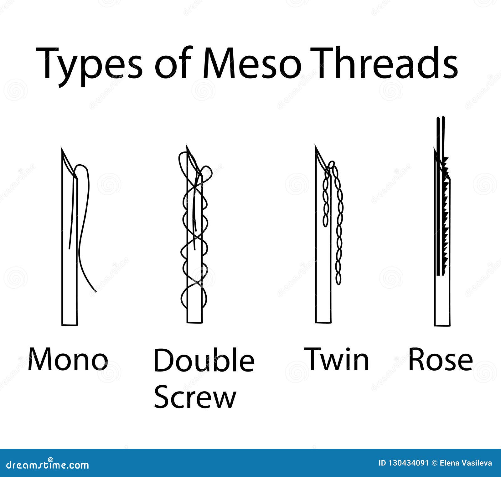 Mesotherapy Threads Lifting. Different Types Of Threads For Facelift ...