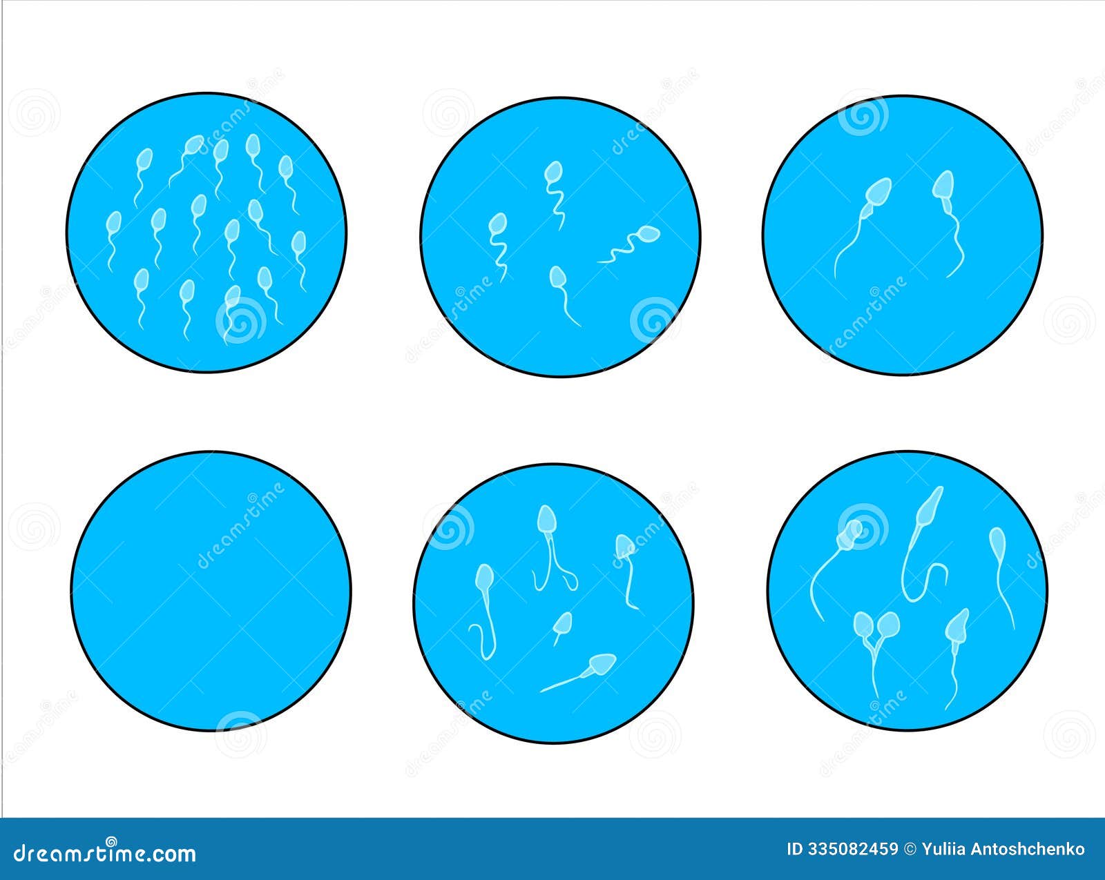 Vector Isolated Illustration of Sperm Pathologies. Spermogram. Sperm ...