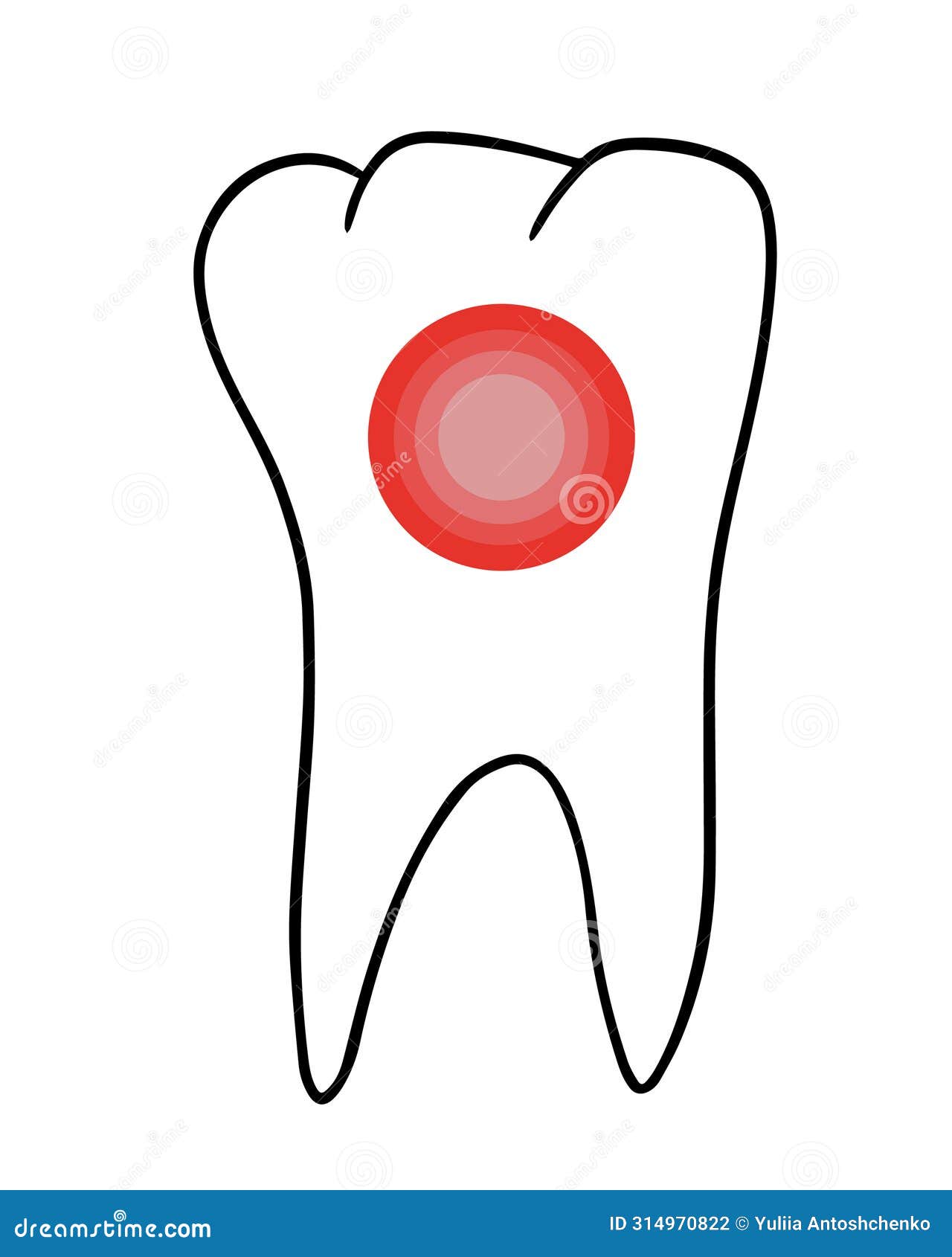 Vector Isolated Illustration of Toothache. Outline Drawing of a Tooth ...