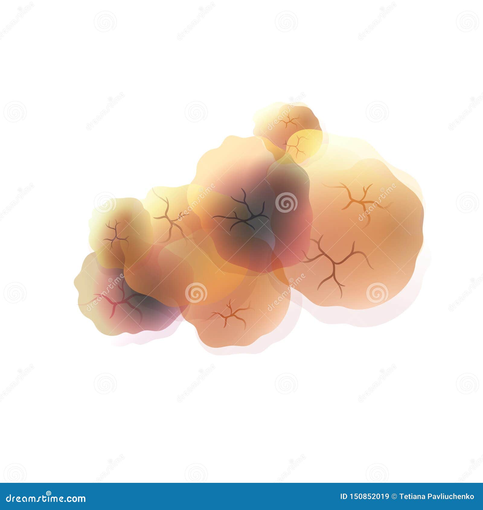 Vector Isolated Illustration of Tumor Stock Vector - Illustration of ...