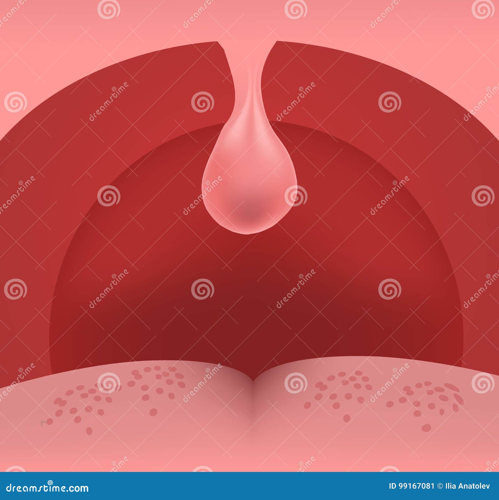 Mouth And Throat Sore Disease Icon Set. Health Dental Clinic Symbol ...