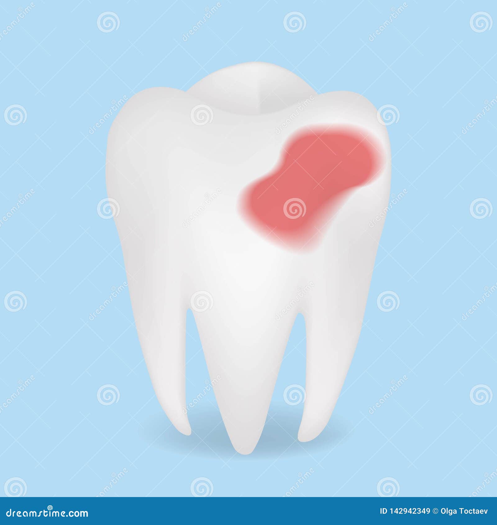 Vector Realistic Red Sick Tooth. Destroy Tooth Stock Vector ...