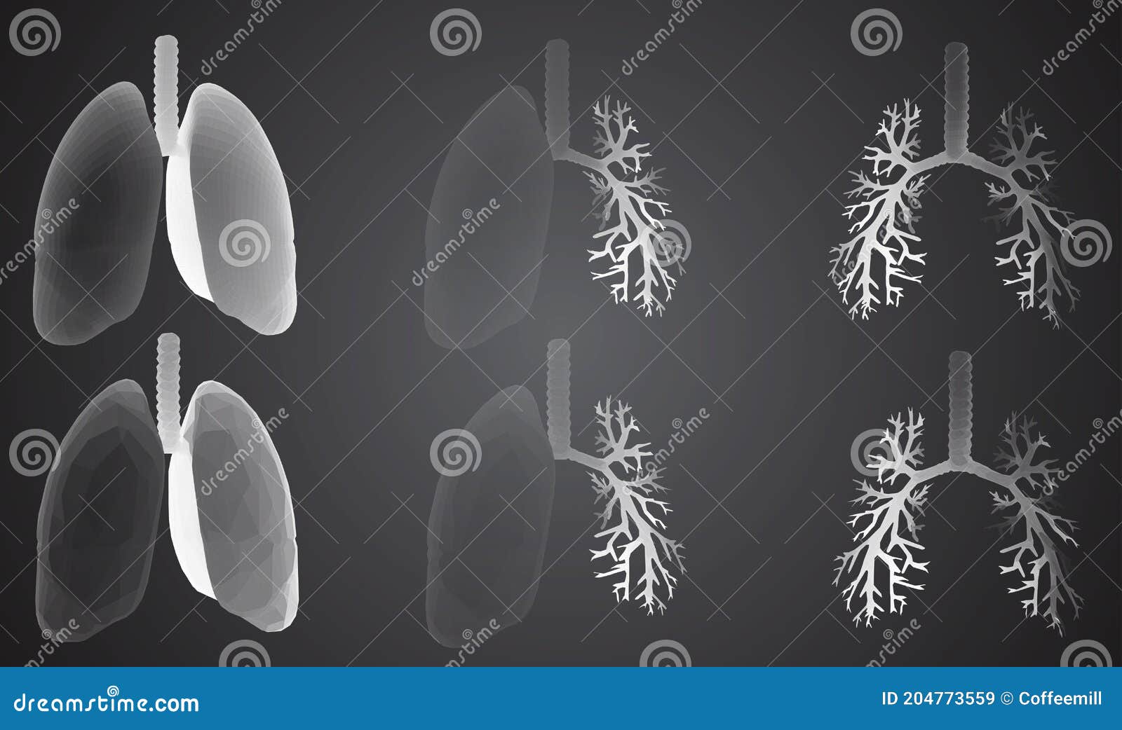 Vector Set 3D Lungs and Bronchus. Isolated on White Background Stock ...