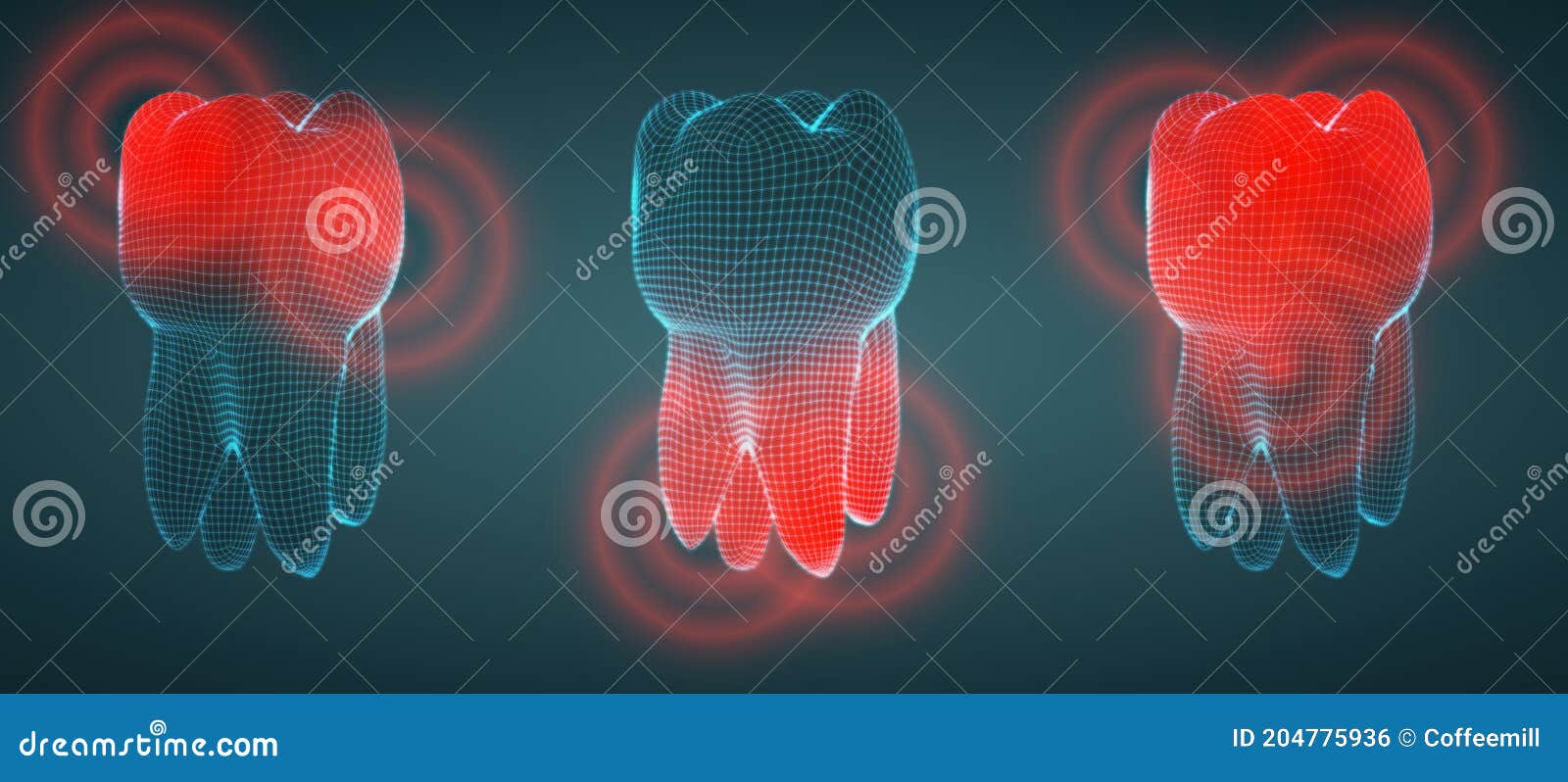 Vector Set of 3d Teeth on a Dark Background. Toothache Stock Vector ...
