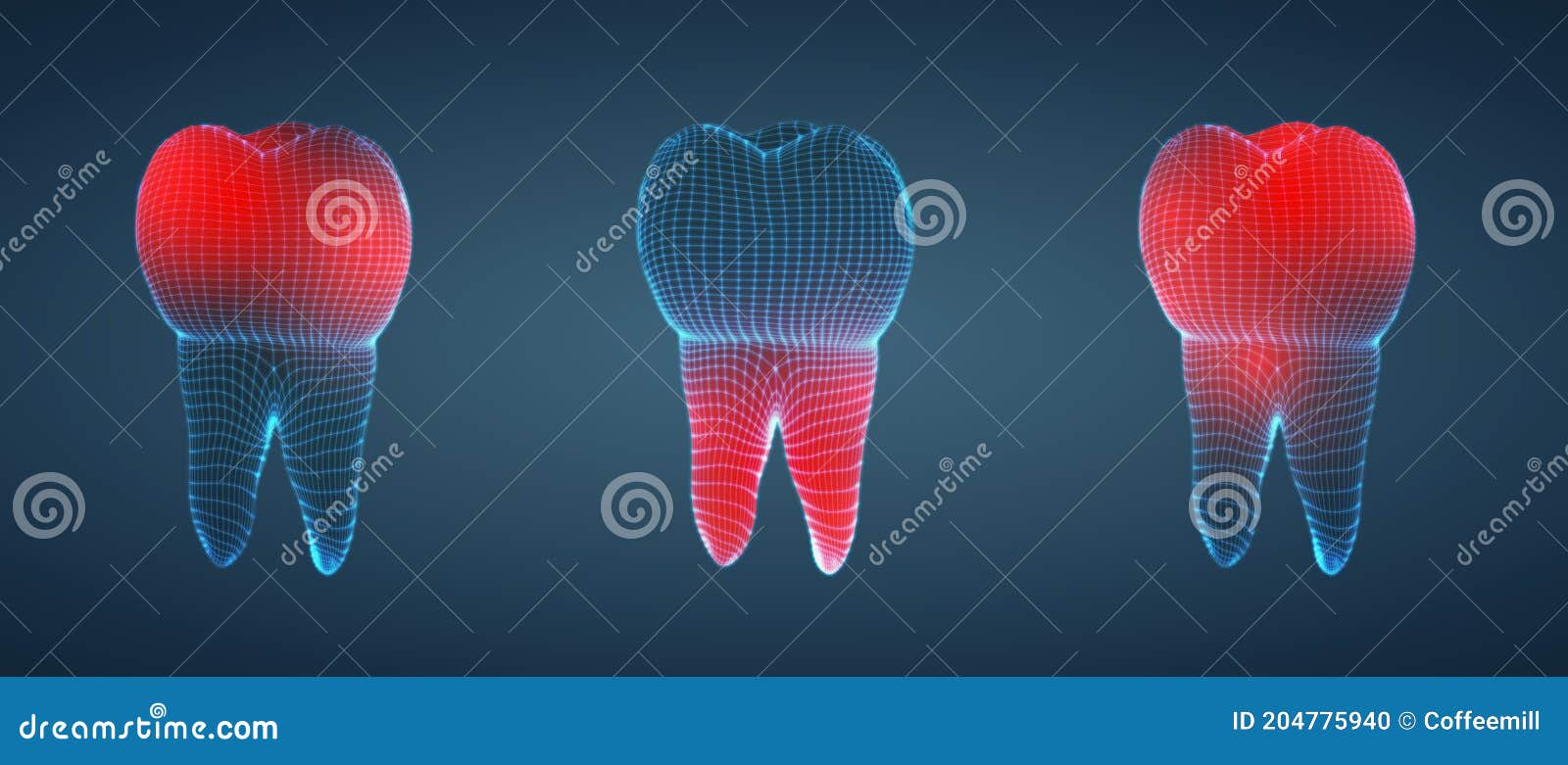 Vector Set of 3d Teeth on a Dark Background. Toothache Stock Vector ...