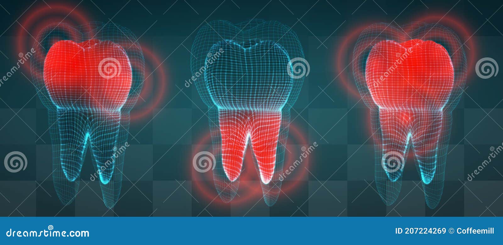 Vector Set of 3d Teeth on a Dark Background. Toothache Stock Vector ...