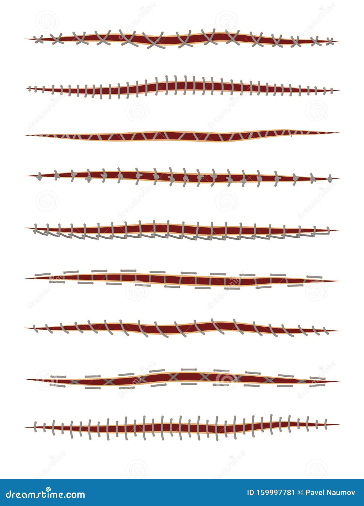 Set with Different Illustrations of Medical Stitches for Injury ...