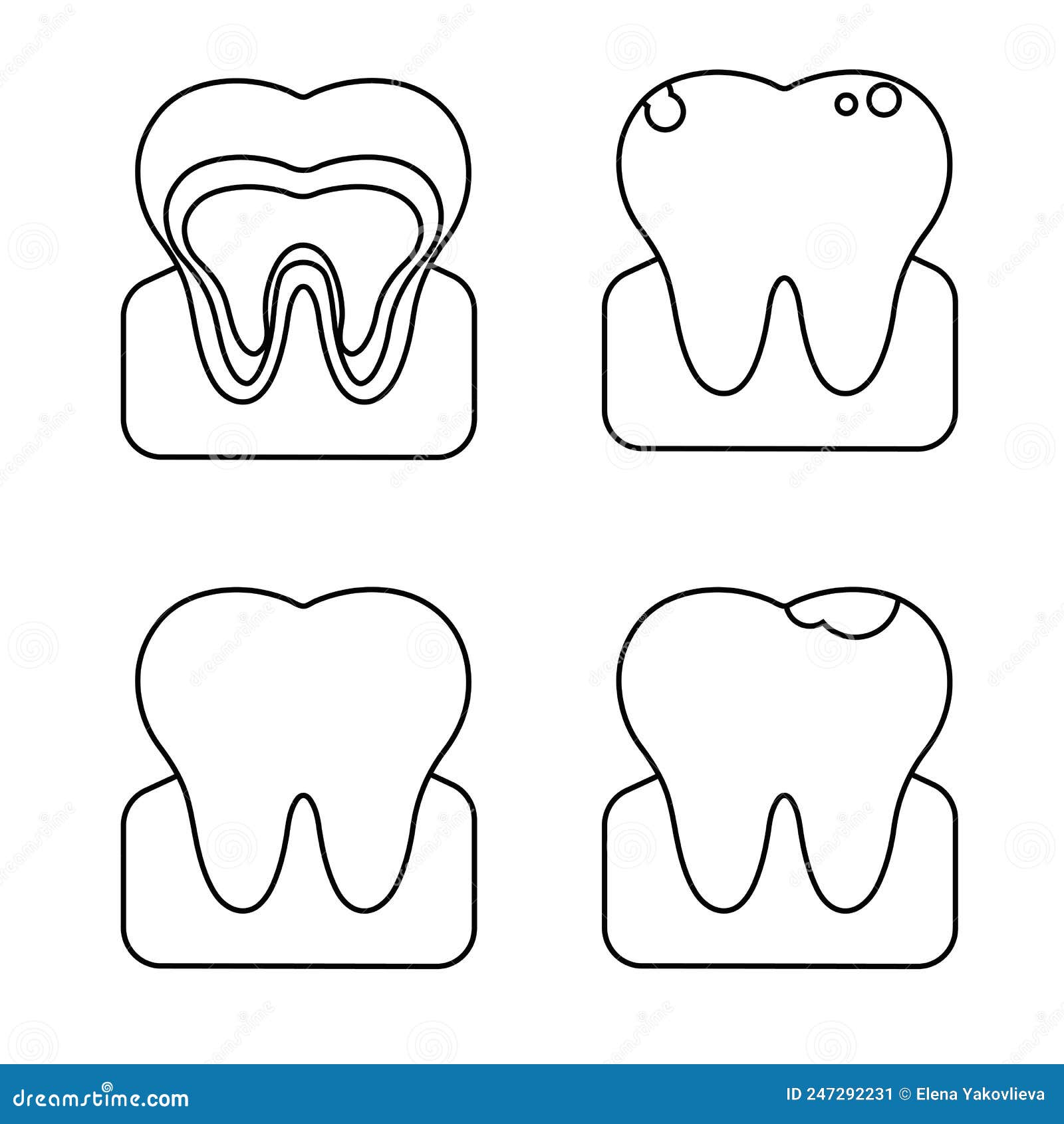 Vector Set of Teeth in Different States. Line Style Illustration Stock ...