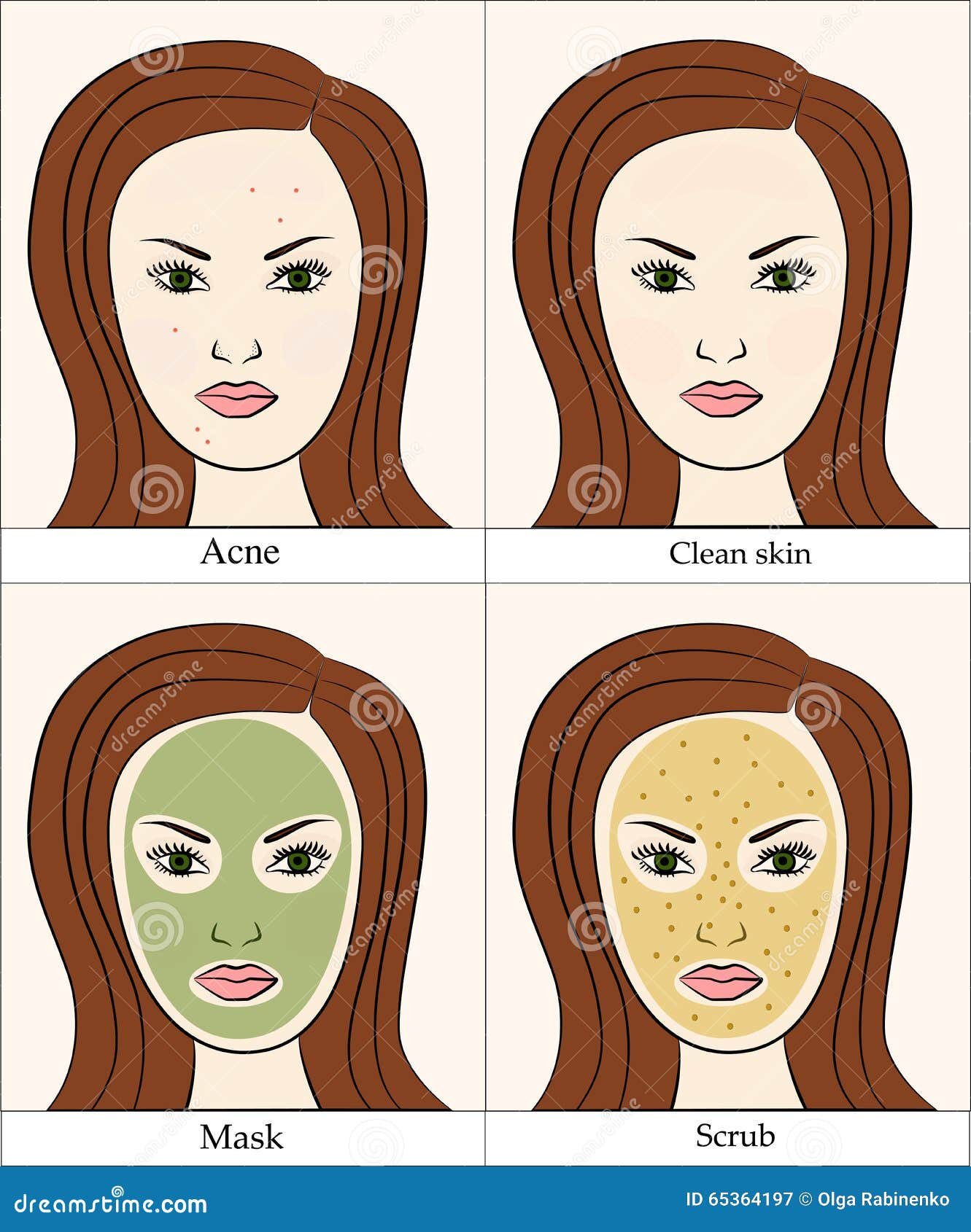 Skin Rashes Dark Dot Whelk Vector Illustration | CartoonDealer.com ...