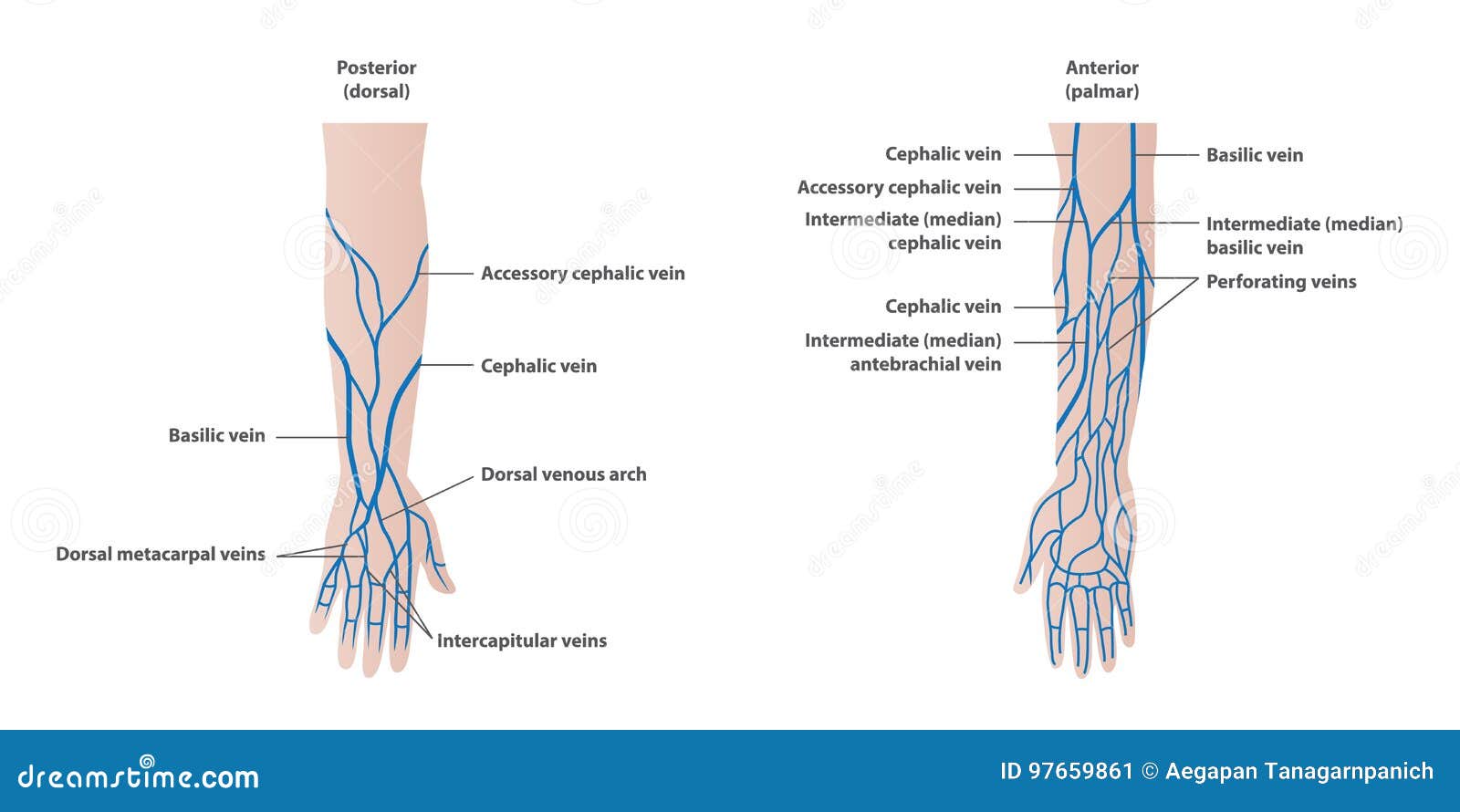 Vein Plotting in the Arm Illustration Vector on White Backgroun Stock ...