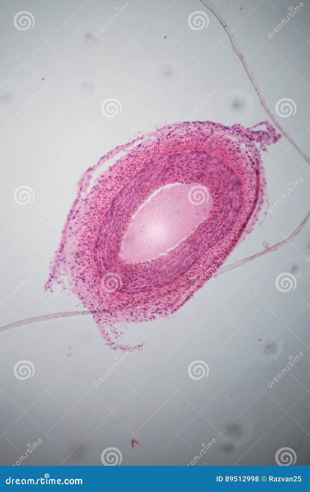 Vein Section Under the Microscope Stock Photo - Image of healthy ...