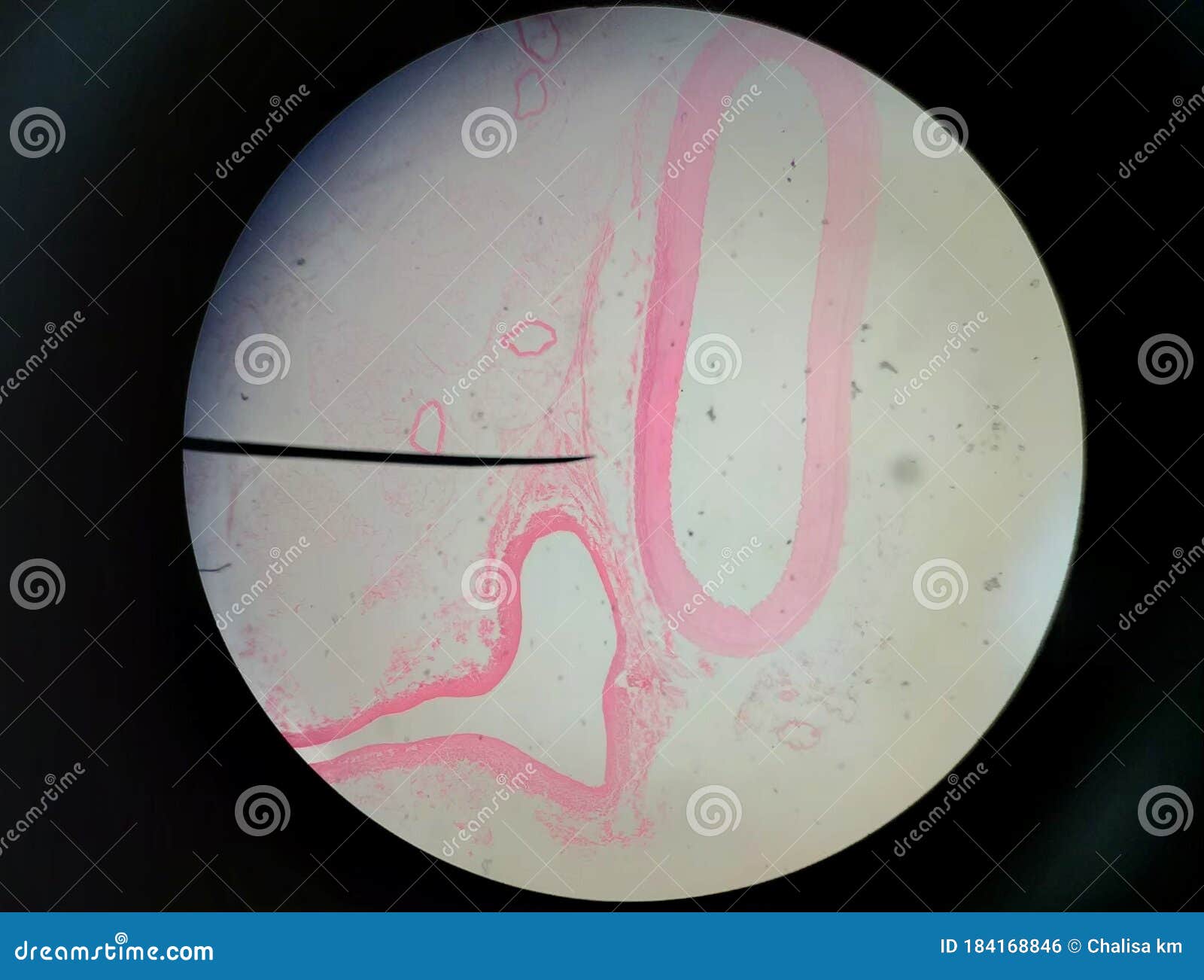 Veins and Arteries that Shines through the Microscope Stock Photo ...