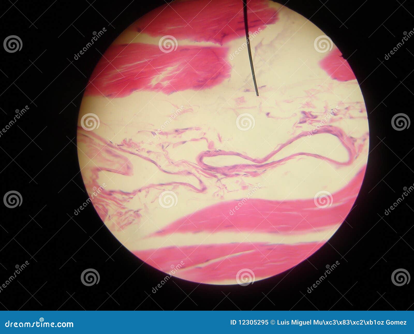 Veins at microscope stock image. Image of microscopia - 12305295