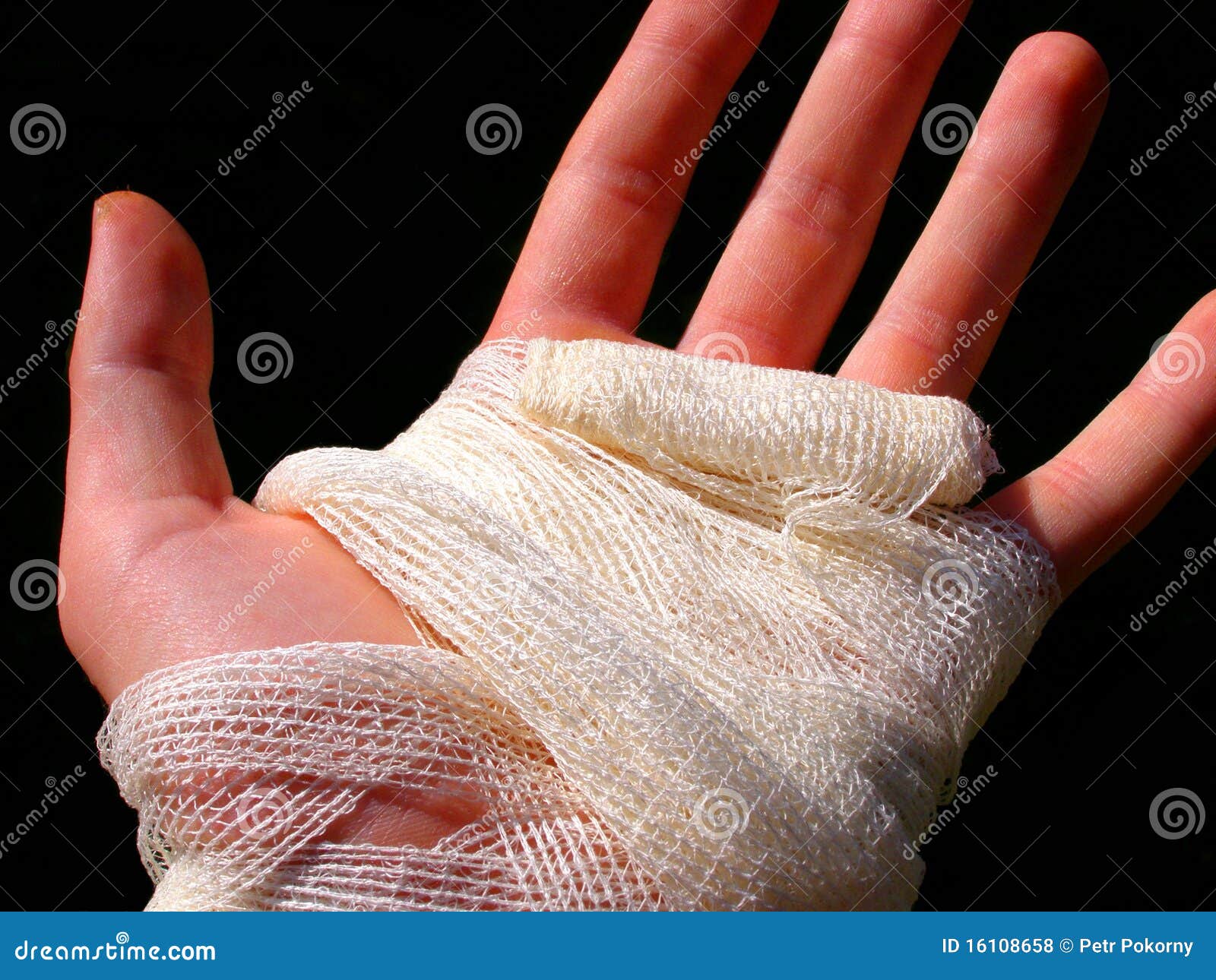 Vendaje de la mano foto de archivo. Imagen de cuidado - 16108658