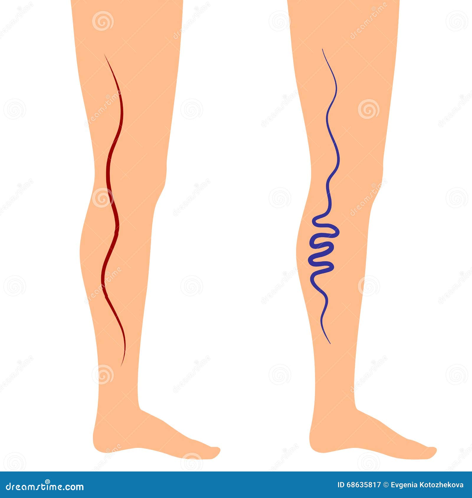 Vene Della Gamba Dell'illustrazione Di Vettore Illustrazione Vettoriale ...