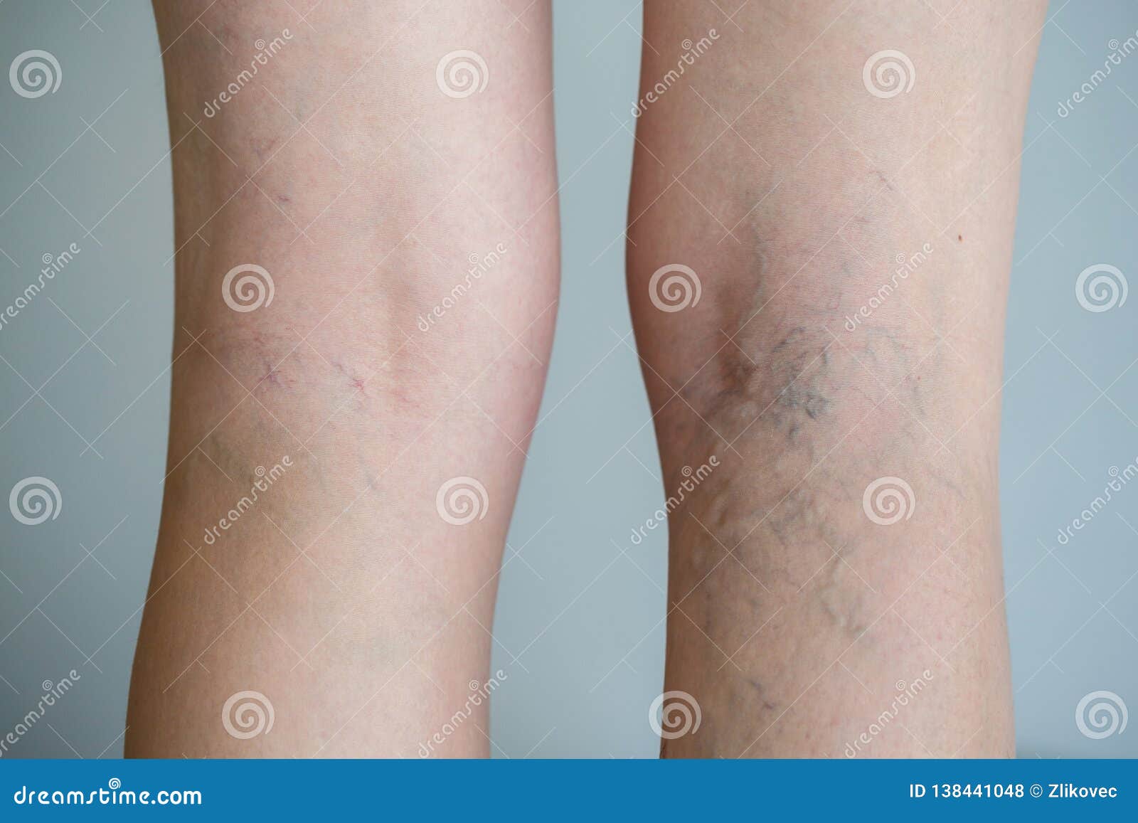 immagini di riserva di Vene - la sovranità di download 33,785 libera le ...