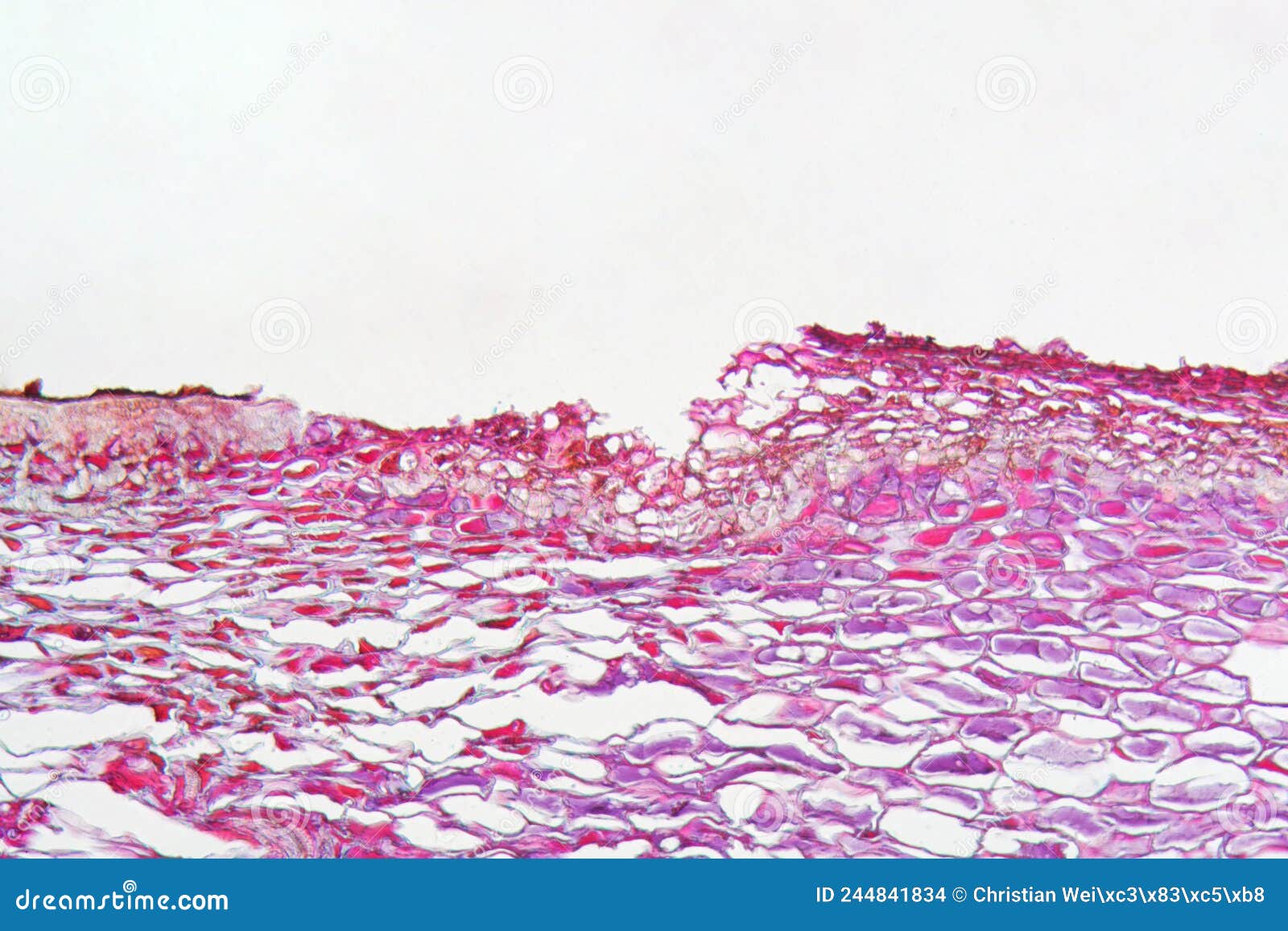 Venturia Pyrina Under the Microscope Stock Photo - Image of pear ...