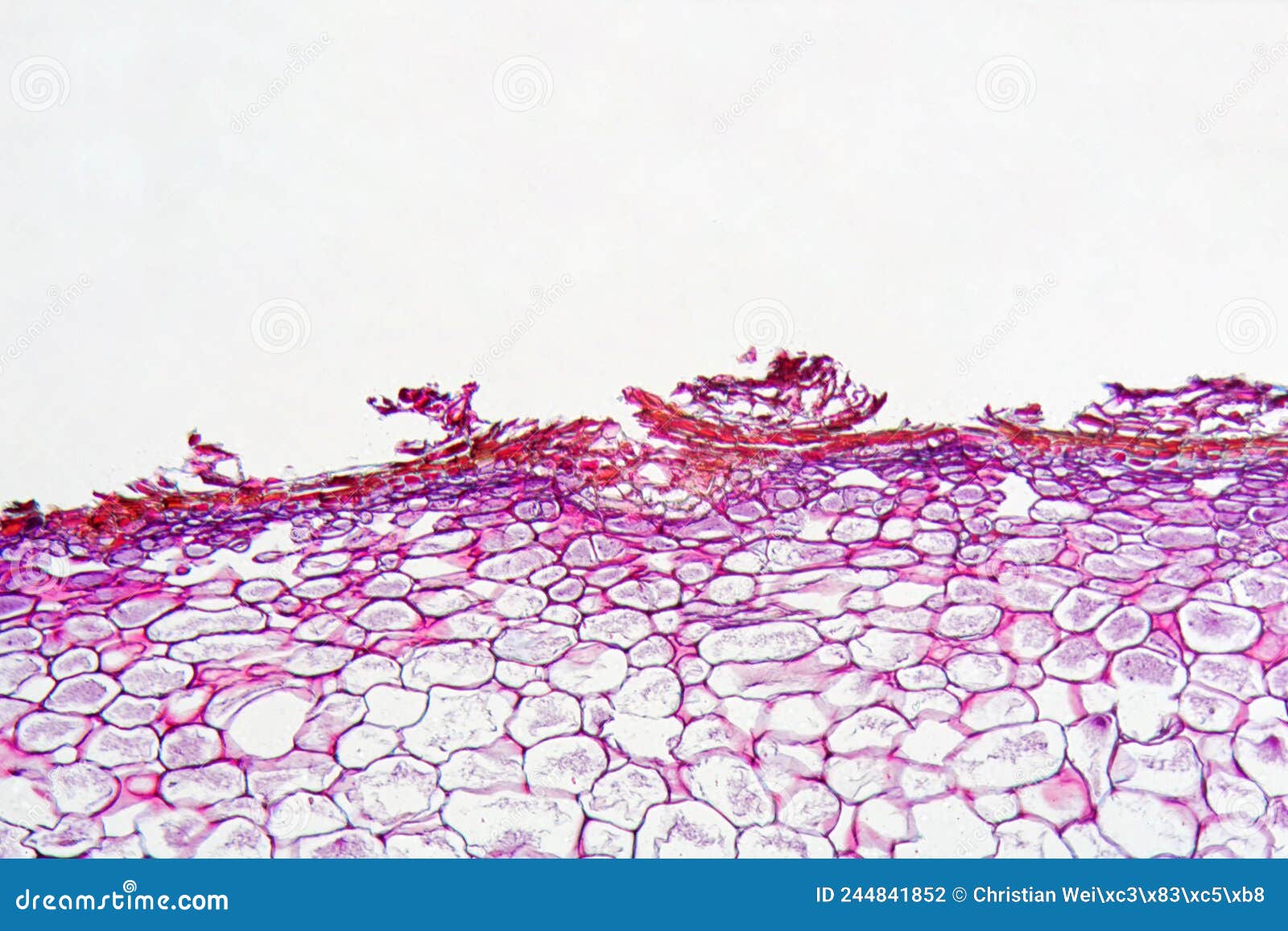Venturia Pyrina Under the Microscope Stock Photo - Image of agriculture ...