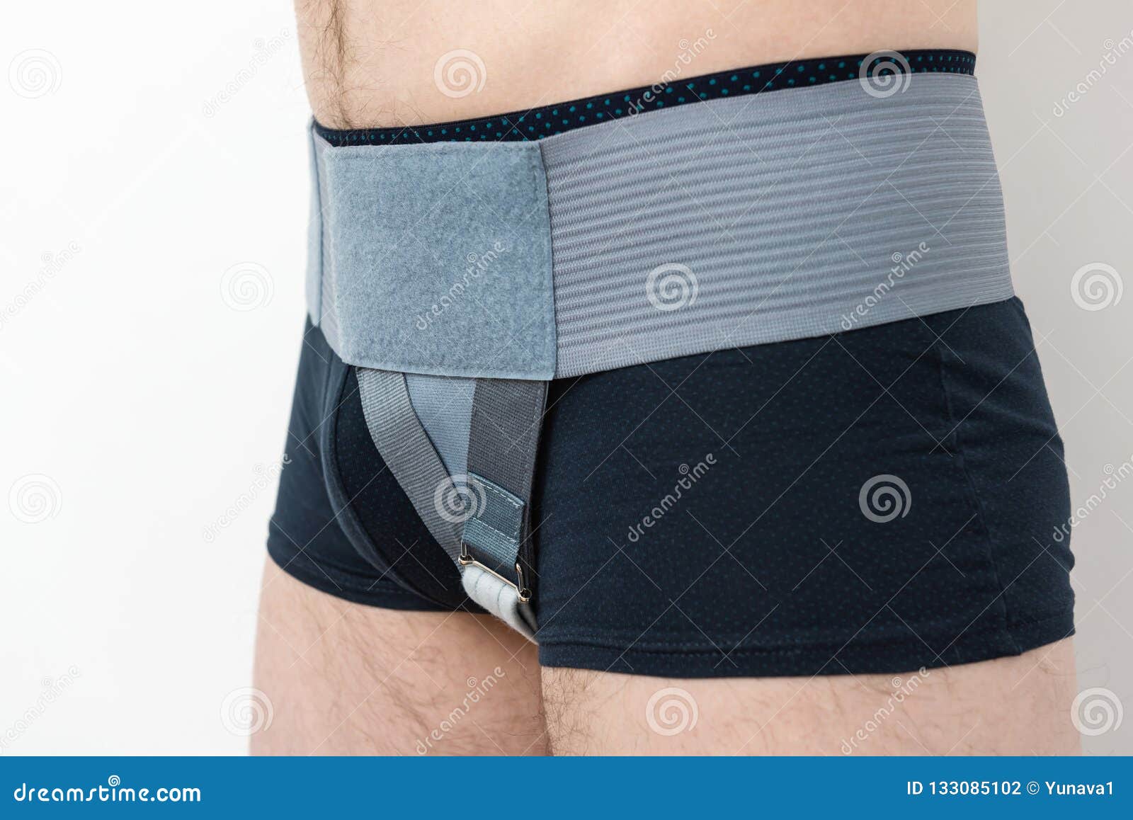 Verbandhernia inguinalis stockfoto. Bild von hernie - 133085102