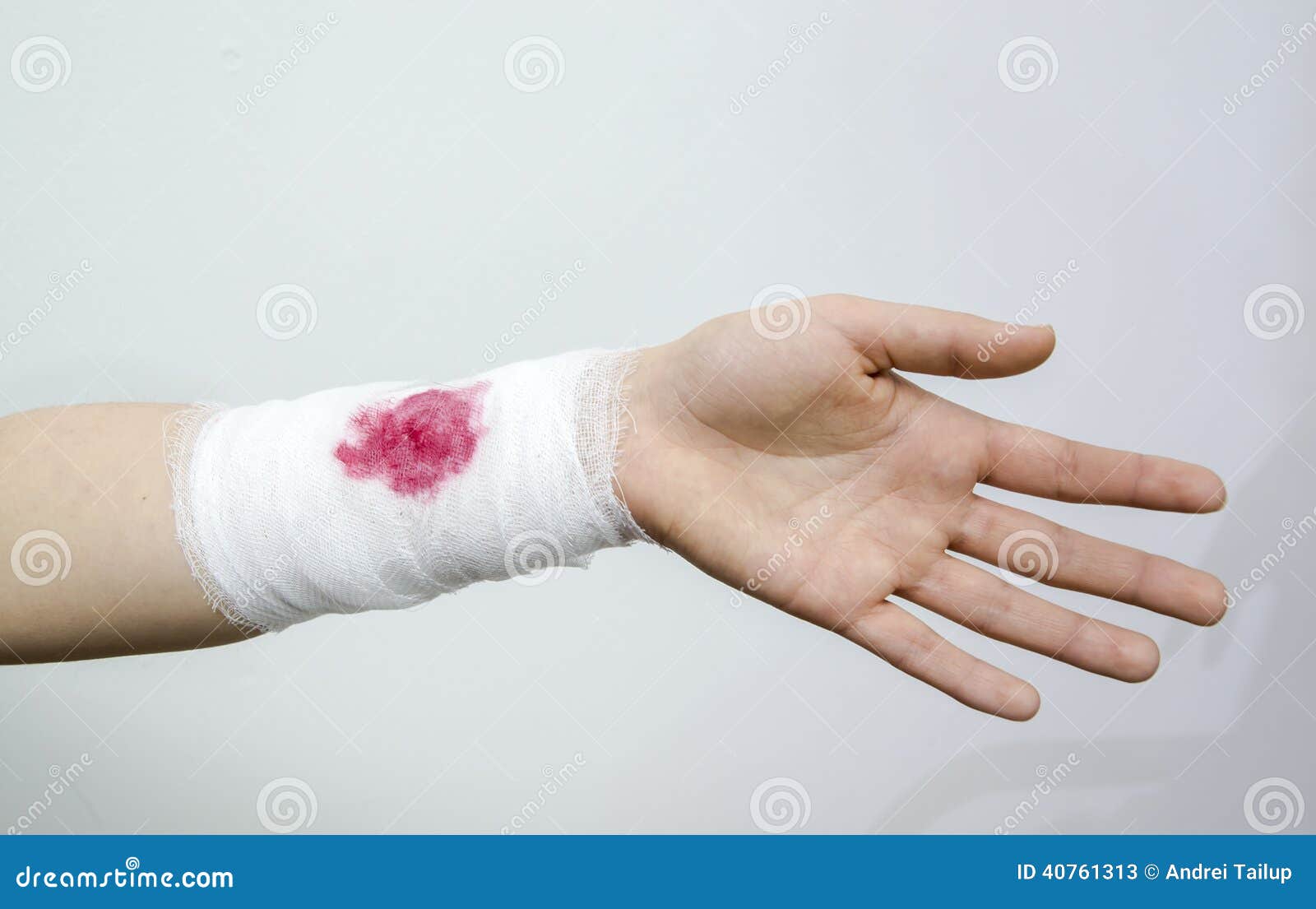 Verbonden wond stock afbeelding. Image of noodsituatie - 40761313