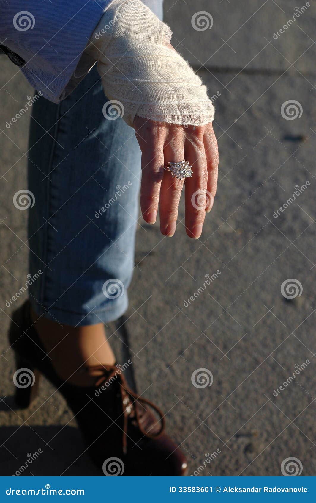 Verletzte Hand stockbild. Bild von verletzt, verletzung - 33583601