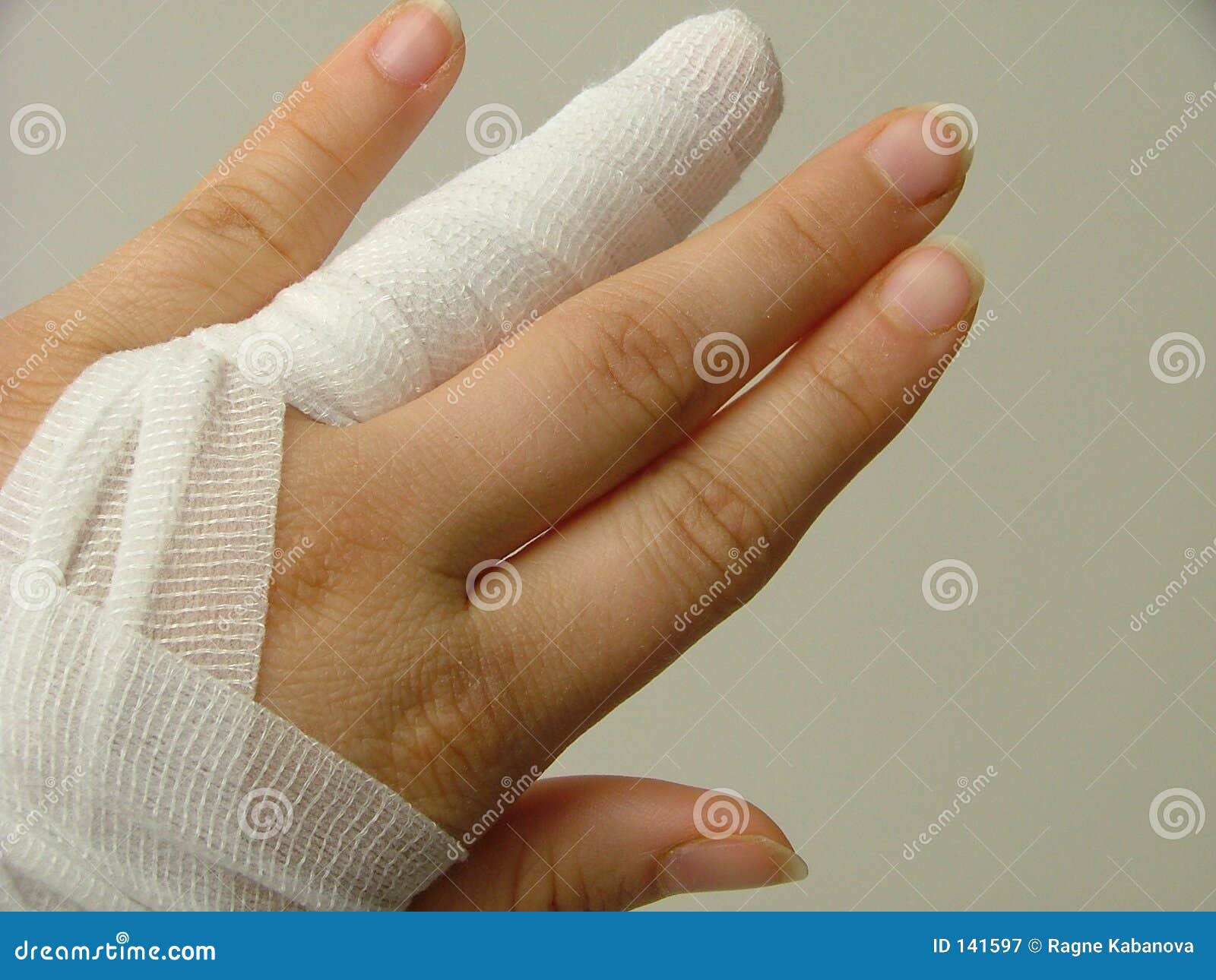 Verletzter Finger stockbild. Bild von glied, gebrochen - 141597