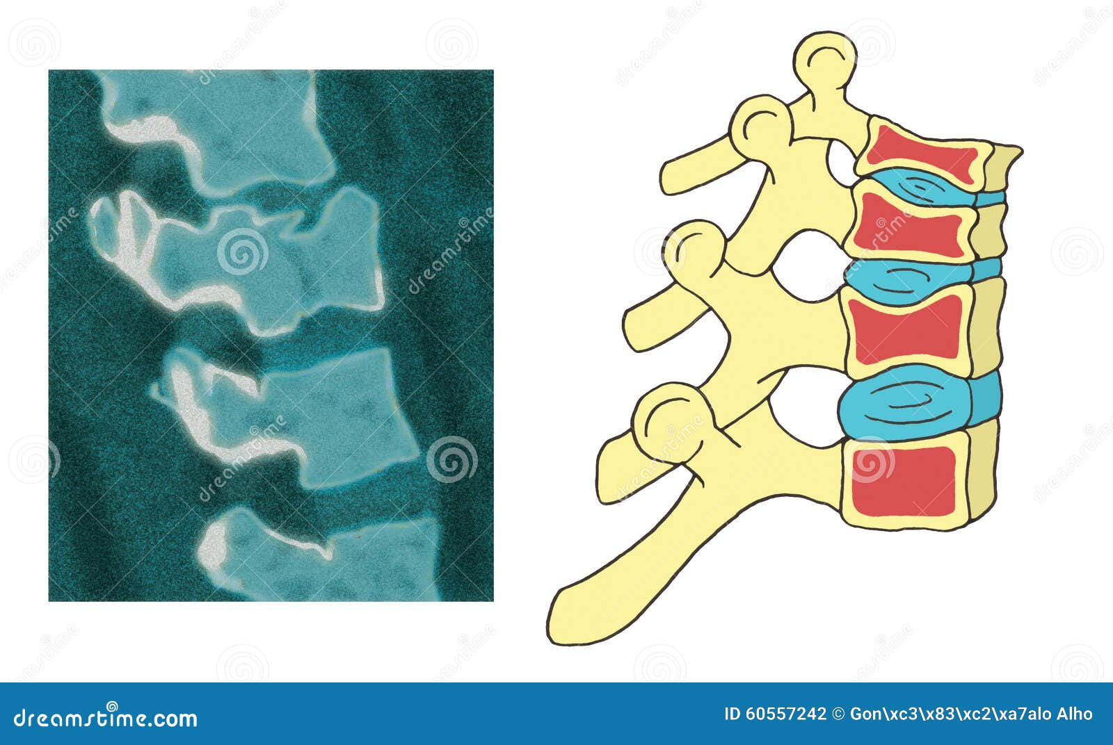 Vertebrae Cartoons, Illustrations & Vector Stock Images - 9496 Pictures ...