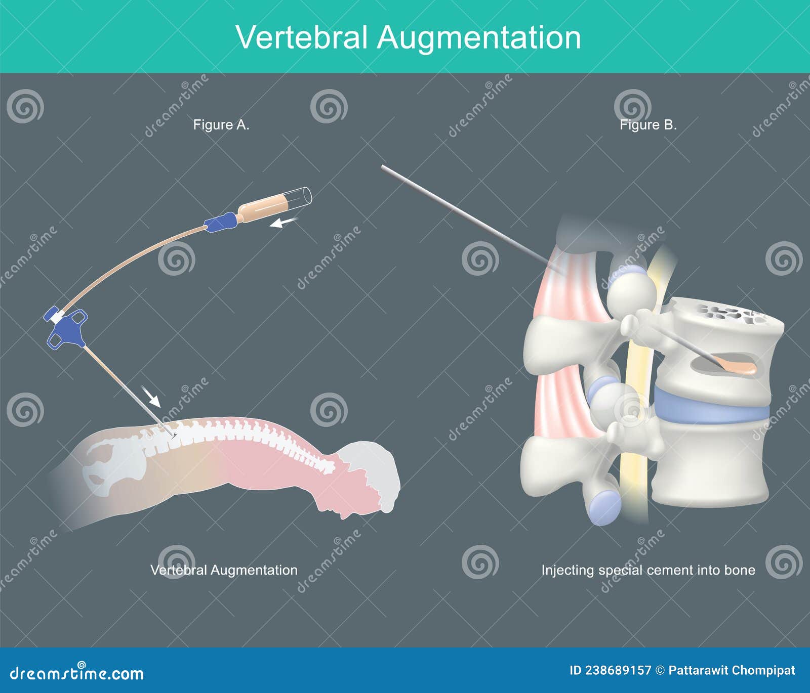 Human Augmentation Concept Icon Cartoon Vector | CartoonDealer.com ...