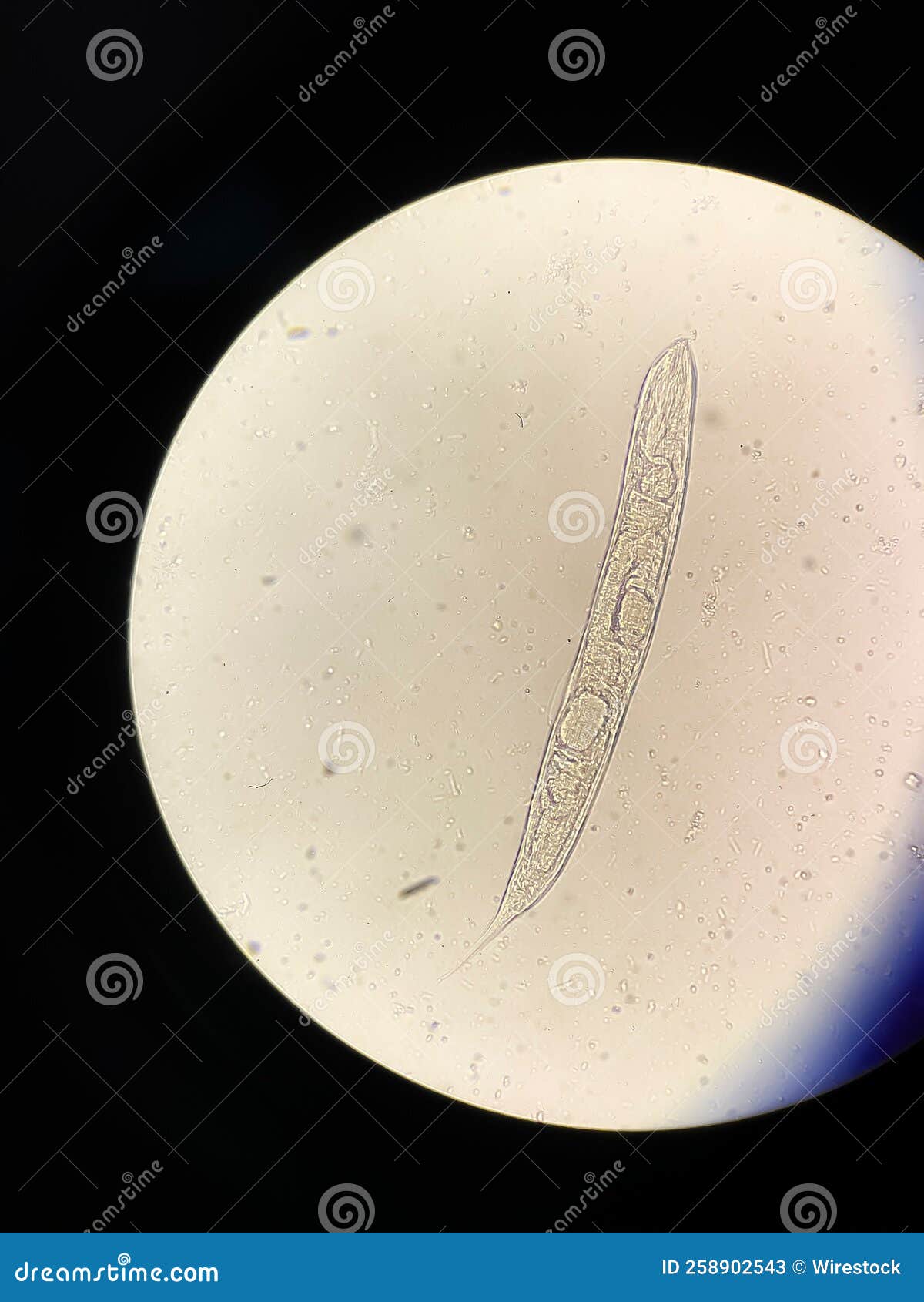 Vertical Shot of a Parasite Stock Image - Image of color, pattern ...