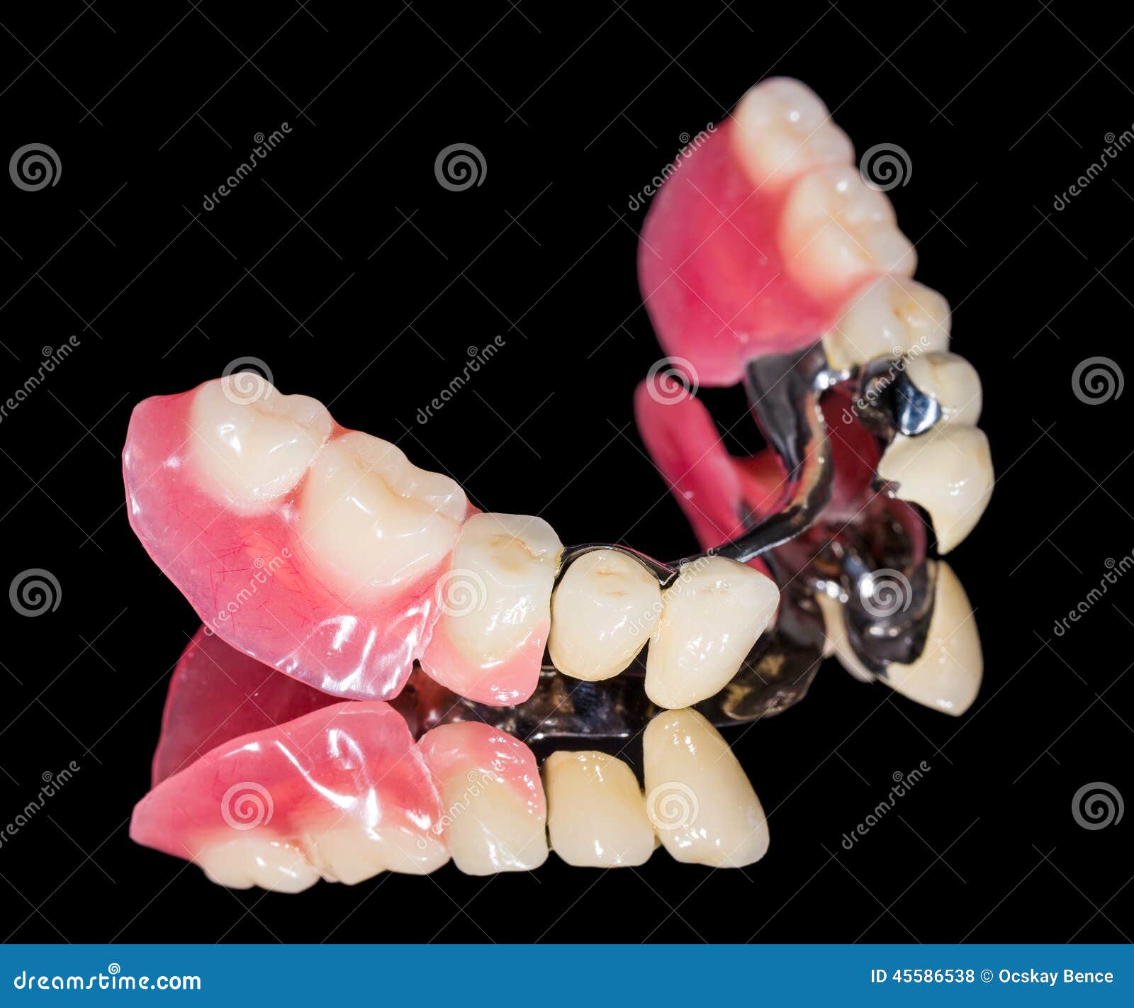 Verwijderbare tandprothese stock foto. Image of orthodontisch - 45586538