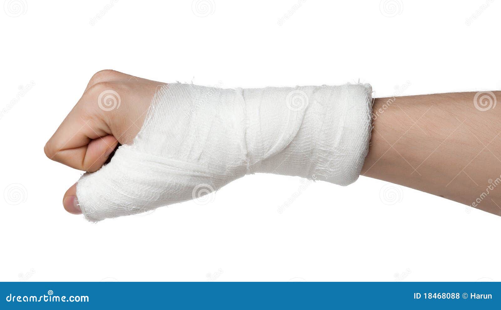 Verwonde Vinger stock foto. Image of gips, lidmaat, verwond - 18468088