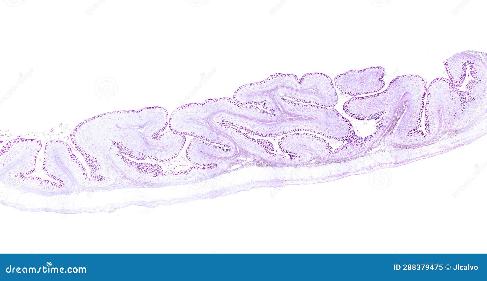 Gastric mucosa. PAS method stock image. Image of mucosa - 288379475