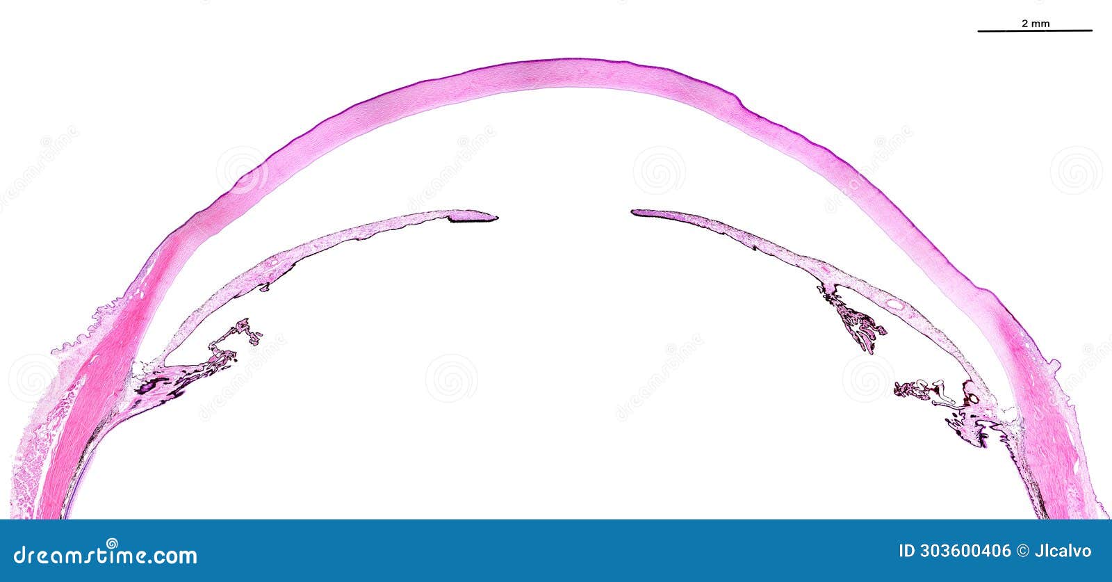 Eye. Anterior pole stock photo. Image of retina, pigmented - 303600406